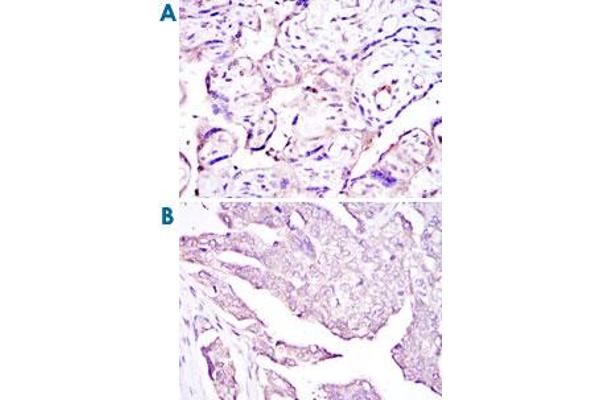 Hpv16 E7 Antibodies
